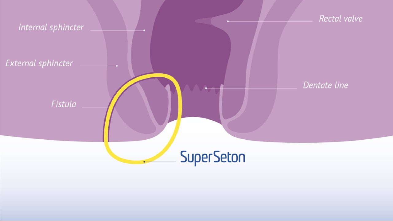 İnvivo Diagnostic – Bir başka WordPress sitesi